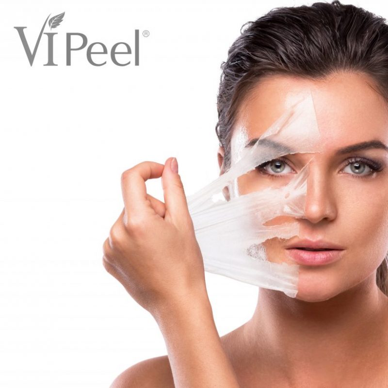 Vi Chemical Peel | NY Beauti